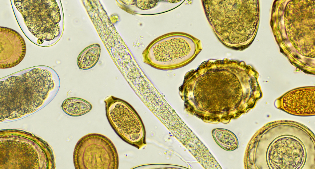 Parasite Protocol - Choice Health Formulas